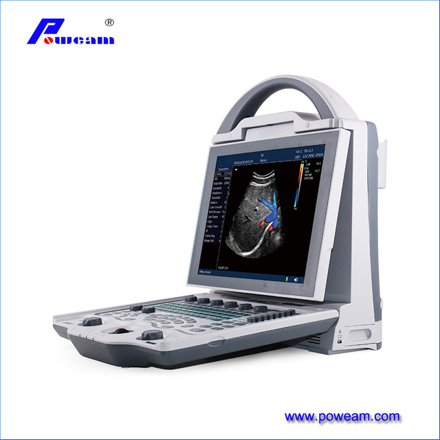 Color Doppler, Hospital Color Doppler - Poweam