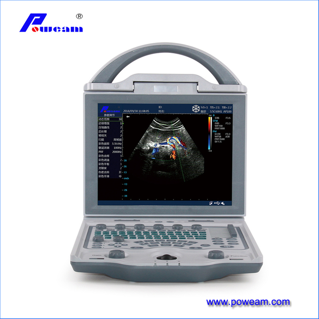 Color Doppler, Hospital Color Doppler - Poweam